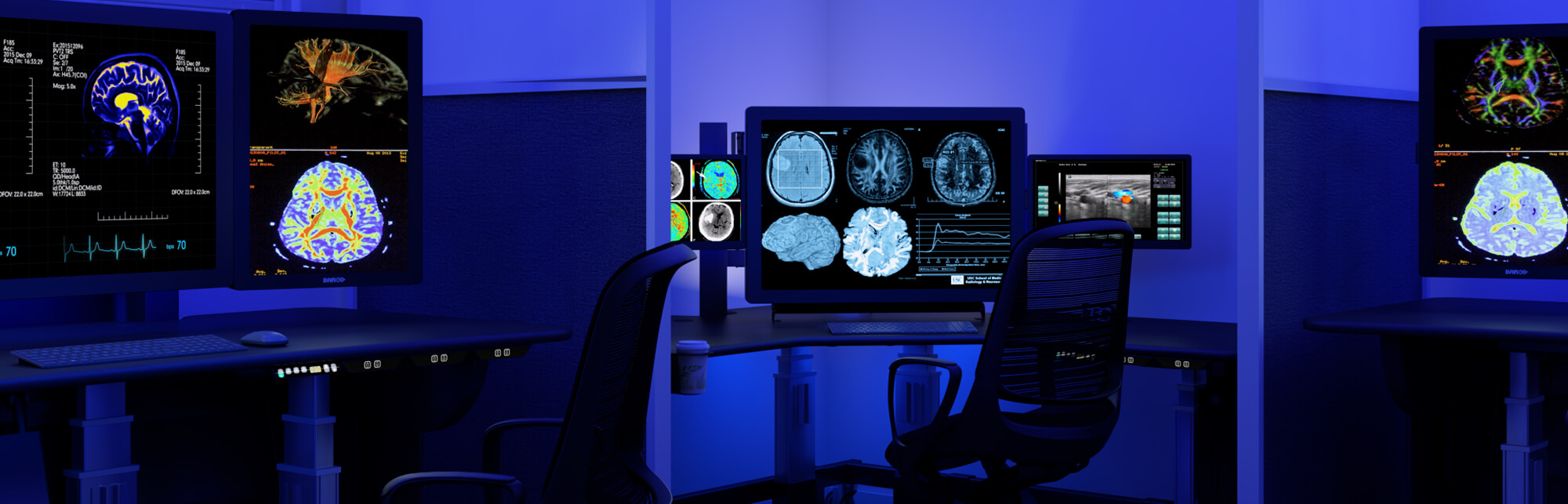 Radiology Workstations for Modern Healthcare | Innovative Solution